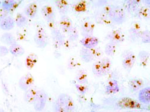 ZytoDot Chromogenic in situ Hybridization (CISH) Probes and Kits - Bio SB