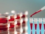 Biospecimen Collection Protocol Creative Bioarray Creative Bioarray