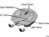 Visual Pathway From The Optic Nerve To The Visual Cortex Deviating Eye