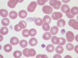 Normal Canine Erythrocytes With Scattered Platelets Wright S Stain