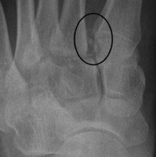 emDOCs.net – Emergency Medicine EducationThe Cleared Trauma Patient ...