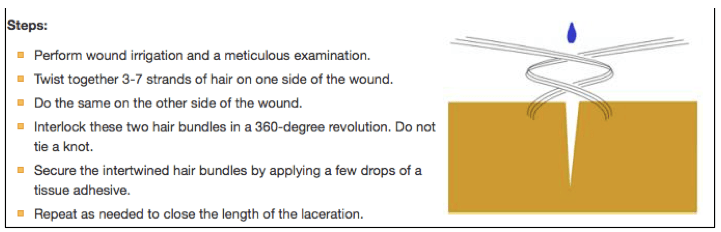 emDOCs.net – Emergency Medicine EducationHEENT: Tips for Addressing ...