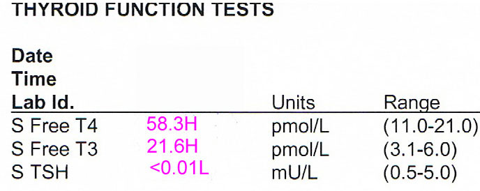 Thyroid Function Tests Endocrinesurgery Net Au