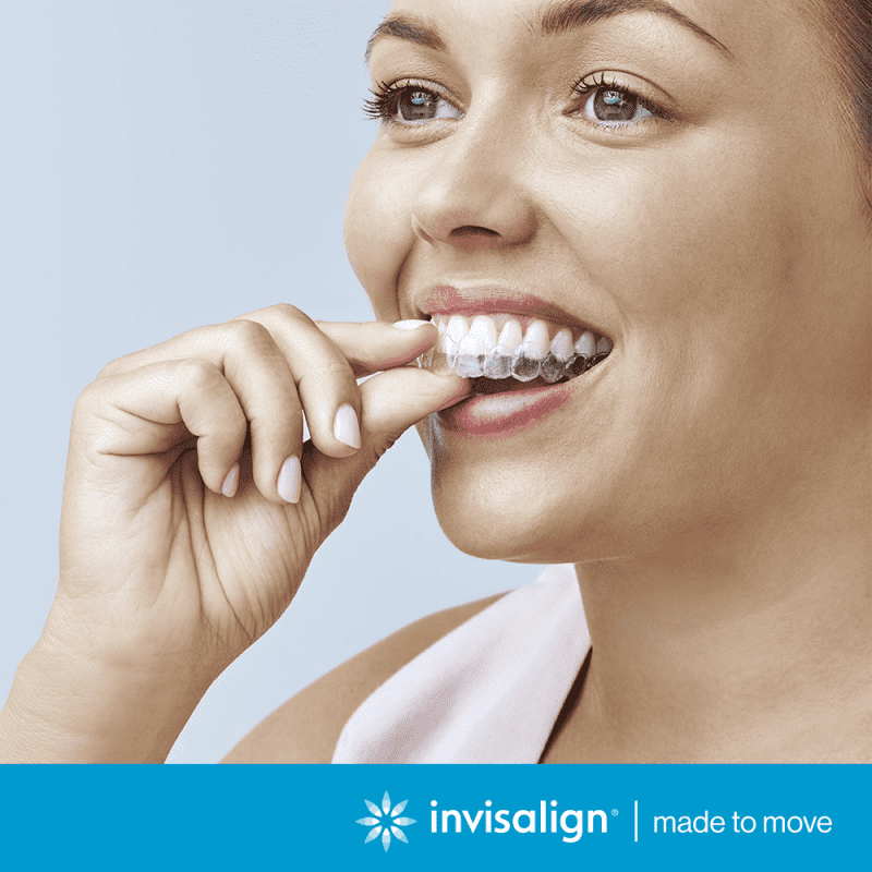 Invisalign Braces