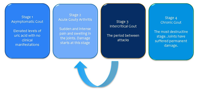 The Four Stages of Gout - Gout Share