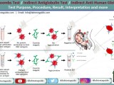 Coombs Test Principle Types Procedure And Result 48 Off