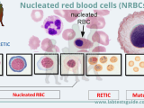 Nucleated Red Blood Cells Vs Lymphocyte