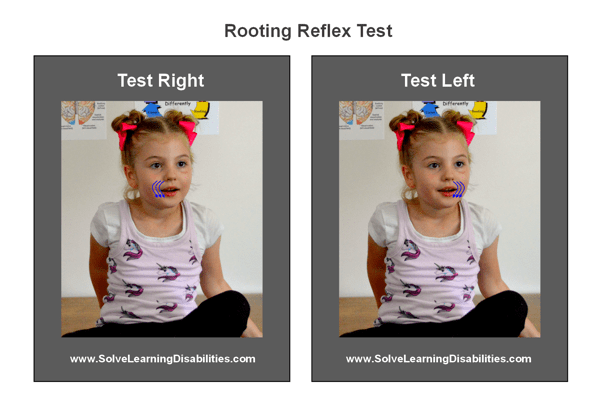 Retained Rooting Reflex - Solve Learning Disabilities