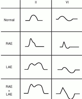 Electrocardiogram Guide (EKG/ECG) – Stepwards