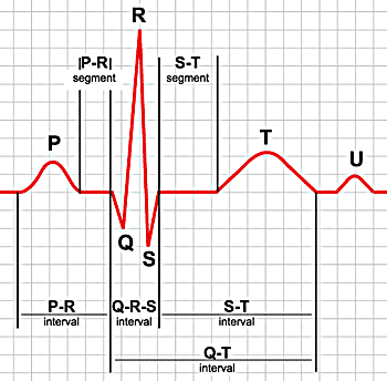 Electrocardiogram Guide (EKG/ECG) – Stepwards