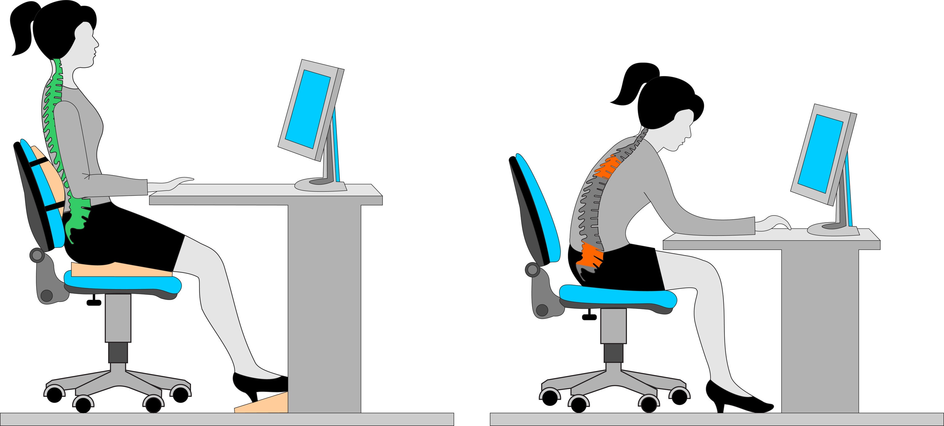 Undesk – Don’t slouch! The benefits of good posture.
