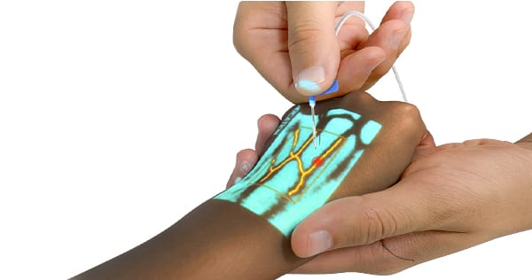 WHAT IS VEINSIGHT VEIN FINDER? – All About Medical Devices