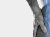 Knee Osteoarthritis Clinical Trial Design An Imaging Based Approach