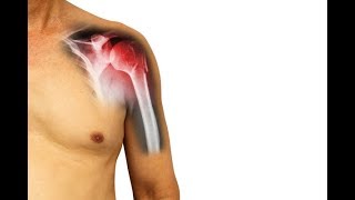 How Is Rotator Cuff Repair Performed? | David Martin MD