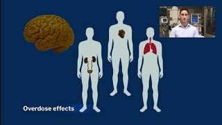 Effects of Opioid Overdose