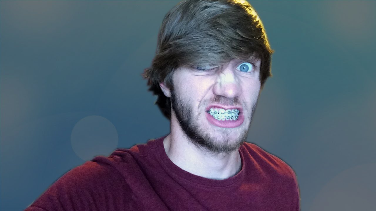 Braces Youtube