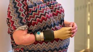 Description and Demonstration of the First Below-Elbow Neuromusculoskeletal Prosthesis