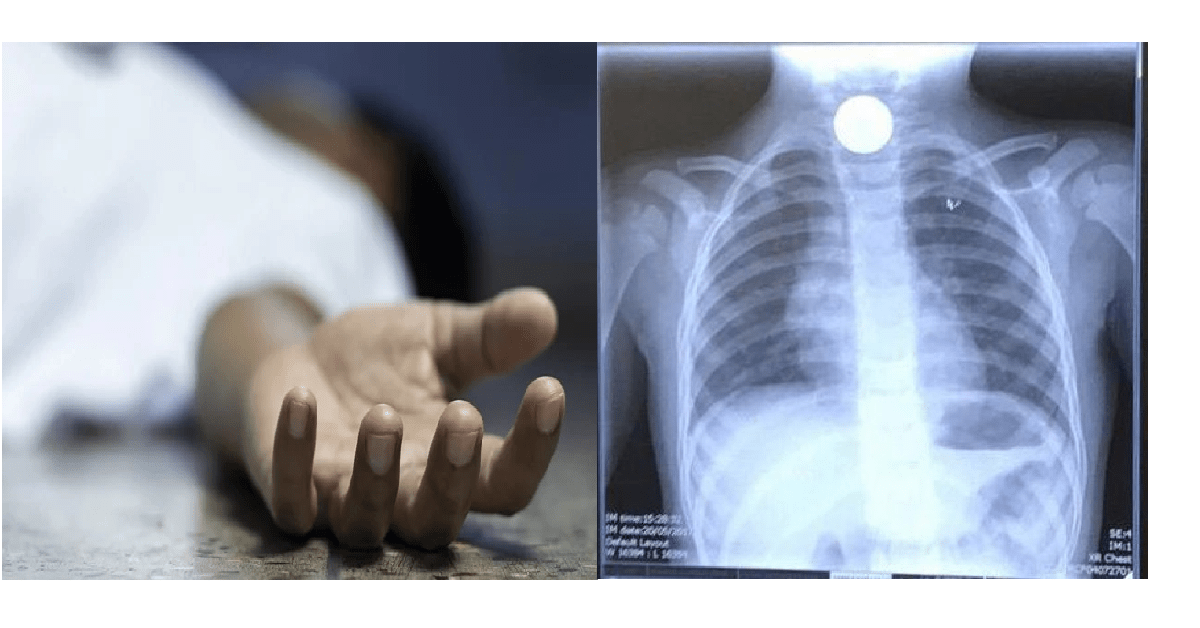 Baby girl chokes to death after swallowing a coin - Zero Thought